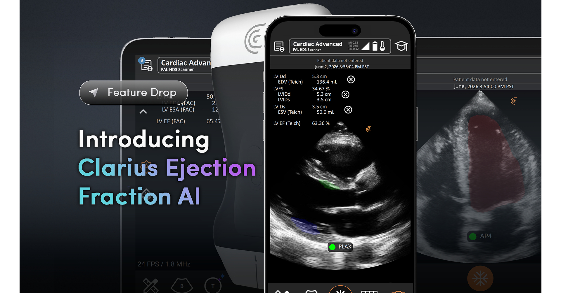 FDA Clears Clarius Ejection Fraction AI to Deliver Objective, Real-Time ...
